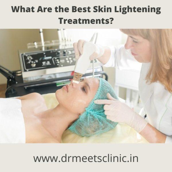 What Are the Best Skin Lightening Treatments?
