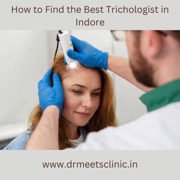 How to Find the Best Trichologist in Indore